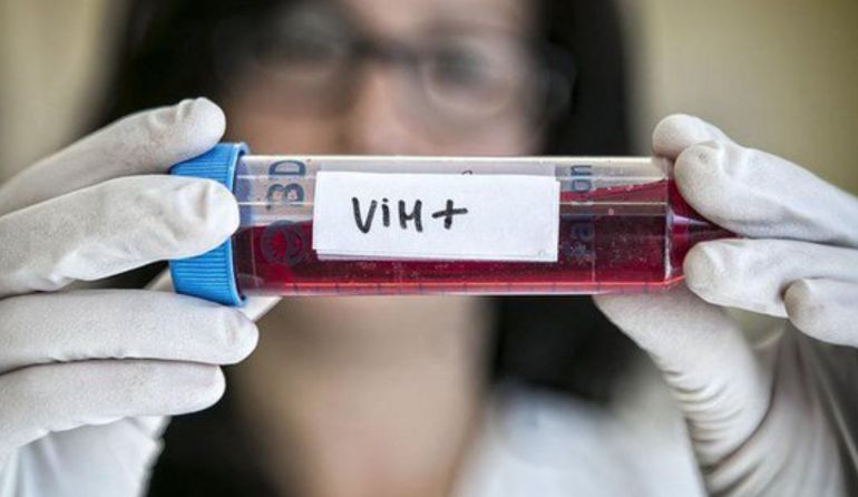 Tratamiento con células madre elimina VIH de seis pacientes ...