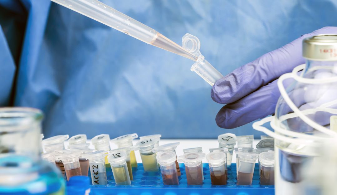 Nueva Cepa De Coronavirus En Chile / EU monitorea avance de nueva cepa ...