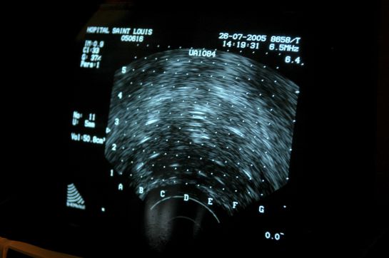 Fuente radiactiva de Iridio-192, ¿Qué es y por qué es peligrosa ...